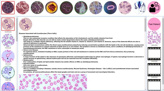 Axfite Pty Ltd (c) 2010 .. 2025 Axfite Pty Ltd Australia